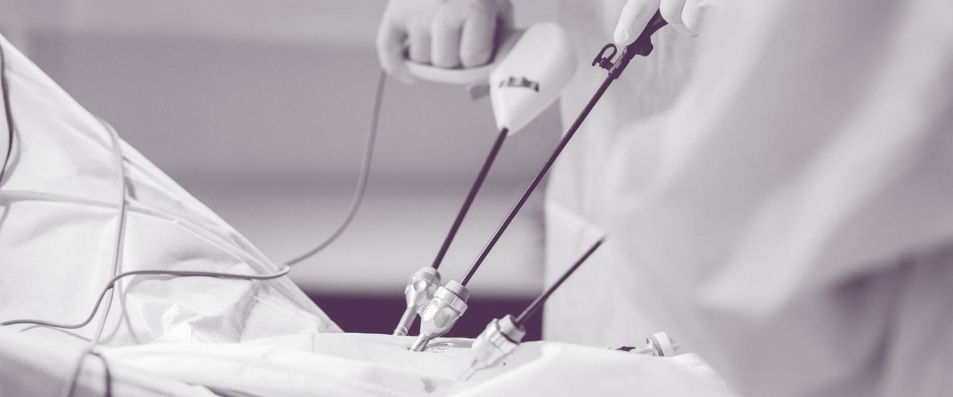 Understanding Appendectomy: What You Need to Know About Cobb Memorial ...